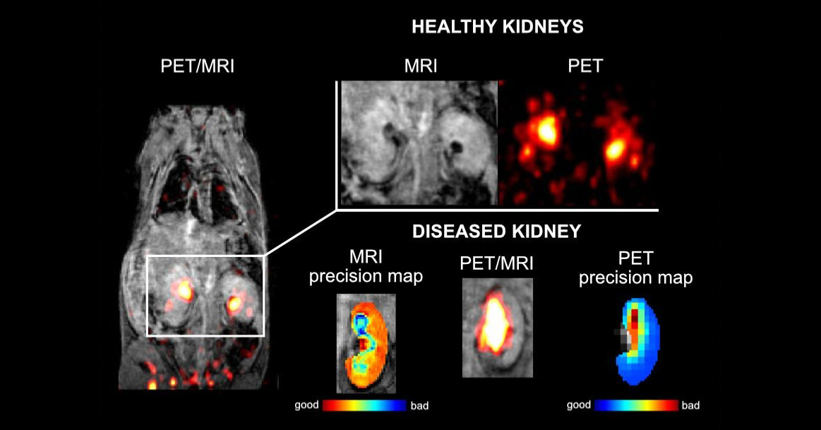 New PET/MRI probe developed by IOCB Prague promises early discovery of ...